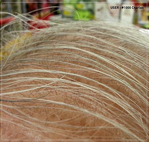 Dr ROSS BIOGEM Hair Loss Treatment | Clinically Proven Shampoo ...