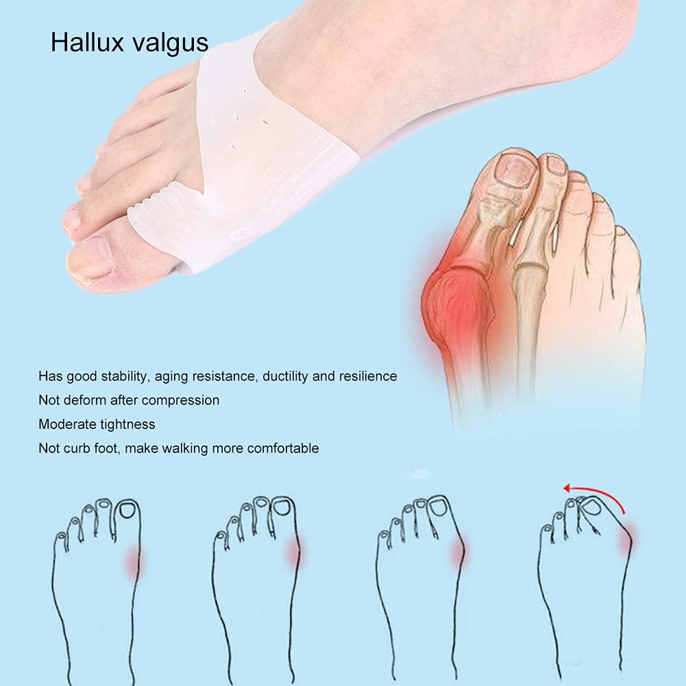 Hallux Valgus Corrector - 2 Pairs Elastic Breathable Toe Separator ...