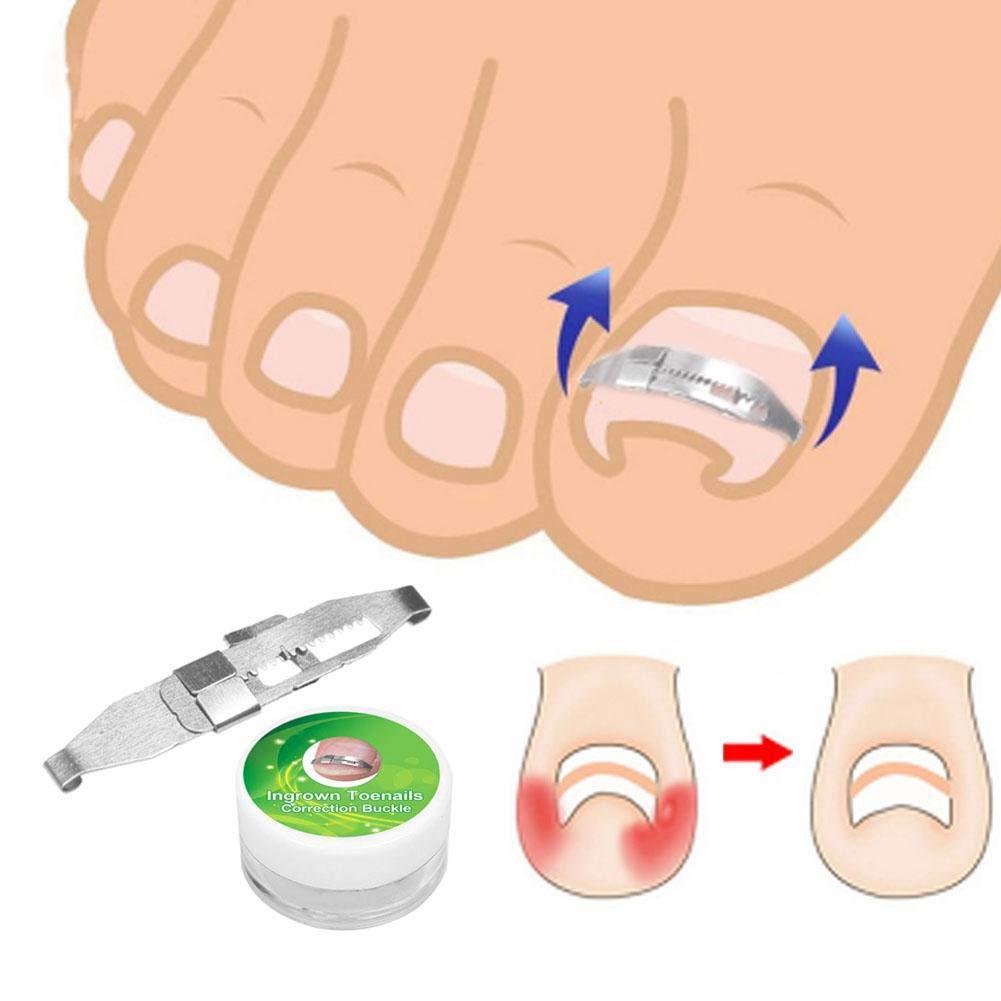 Sonew Stainless Steel Ingrown Toenail Correction Tool | Pain Relief ...