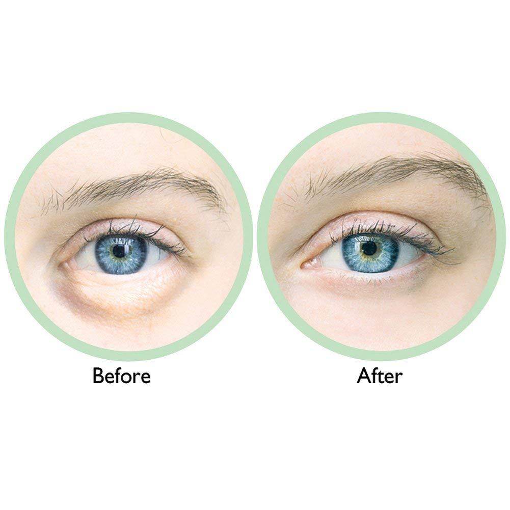 (Set of 2) Puffy Eye Relief Roll-On | Cools Skin and Reduces Under Eye ...