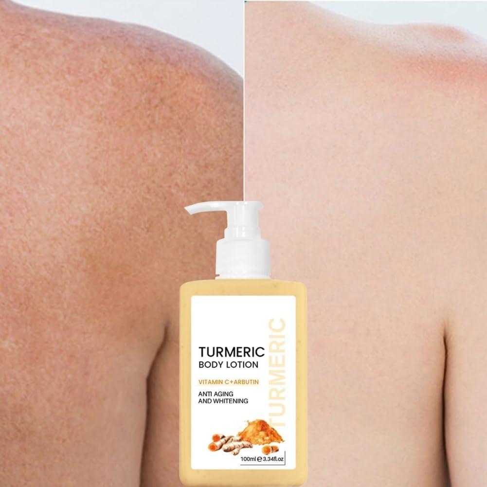 Hocossy Turmeric Body Lotion 100ml - Brightening, Moisturizing, Remove ...