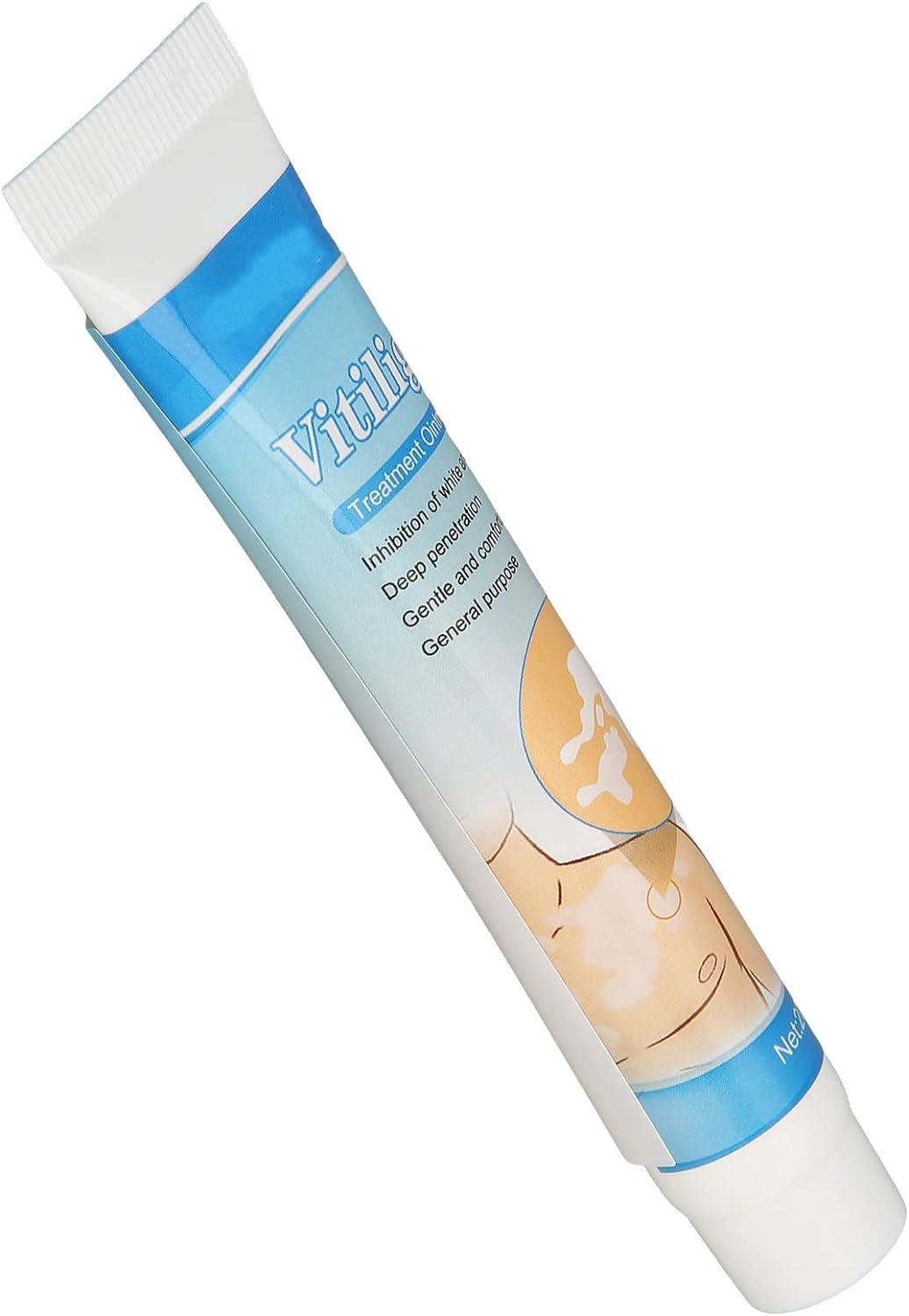 Vitiligo Treatment Cream for White Spots & Skin Pigmentation 0.7oz ...
