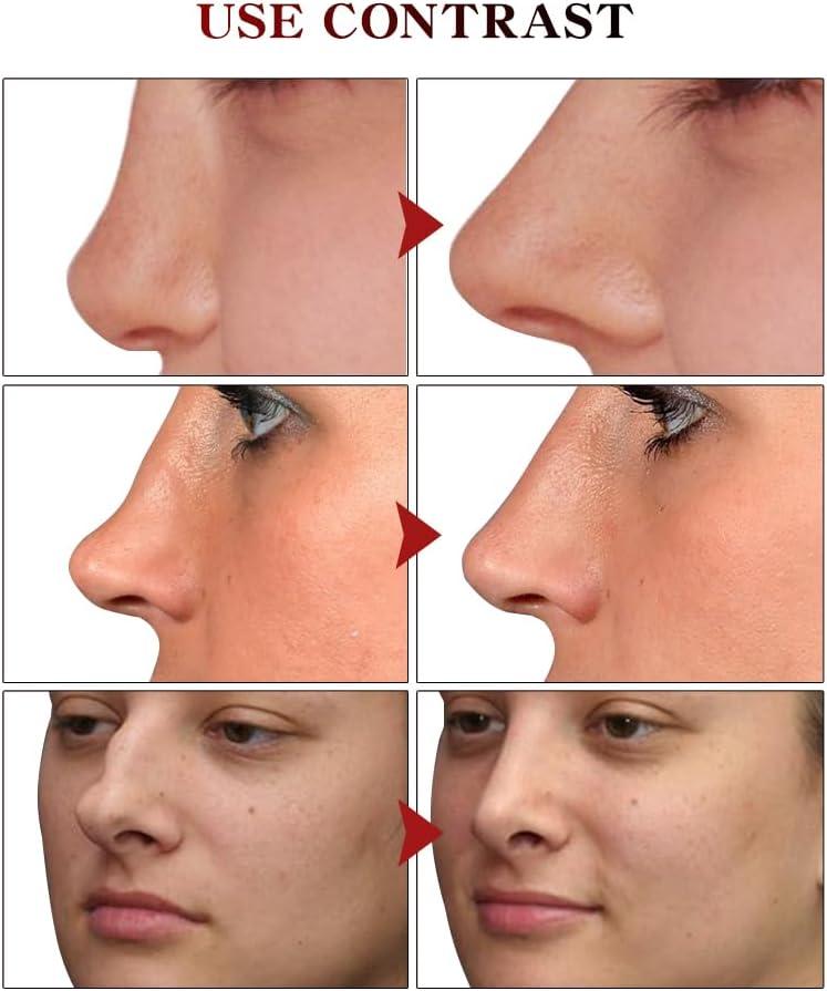 ROEDAX Beautiful Nose Essential Oil - Rhinoplasty & Nose Firming 30ml ...