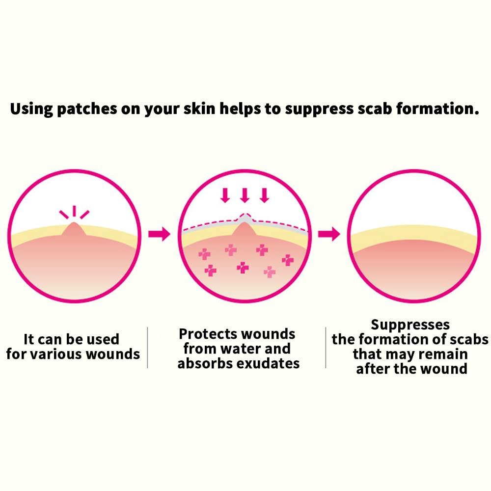 TOSOWOONG SOS Repair CICA Clinic Magic Patch (60 Count) | Hydrocolloid ...