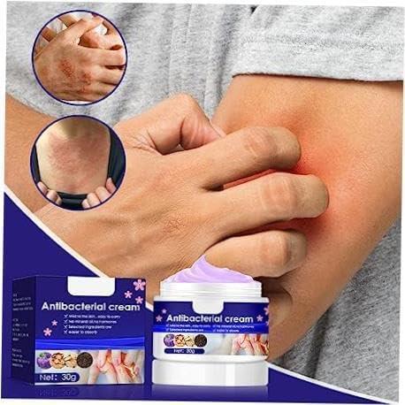 Natural 30g Itch Relief Cream for Bites & Rashes - Anti-Itch Ointment ...