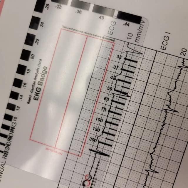 EKG PVC Badge Card for Accurate ECG Interpretation, No Calipers Needed ...