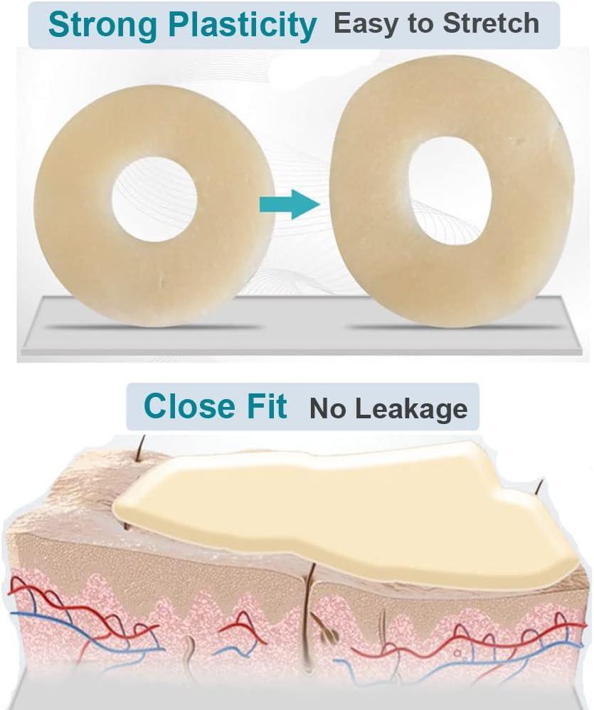 Ostomy Barrier Rings 2mm-10pcs | No Leaking Barrier Extenders for ...