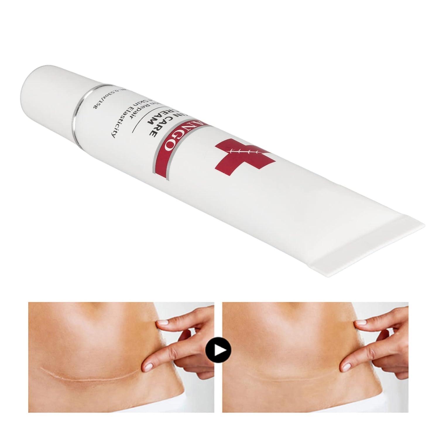 Nourishing Plant Based Scar Cream for Safe & Gentle Scar Repair | Buy ...