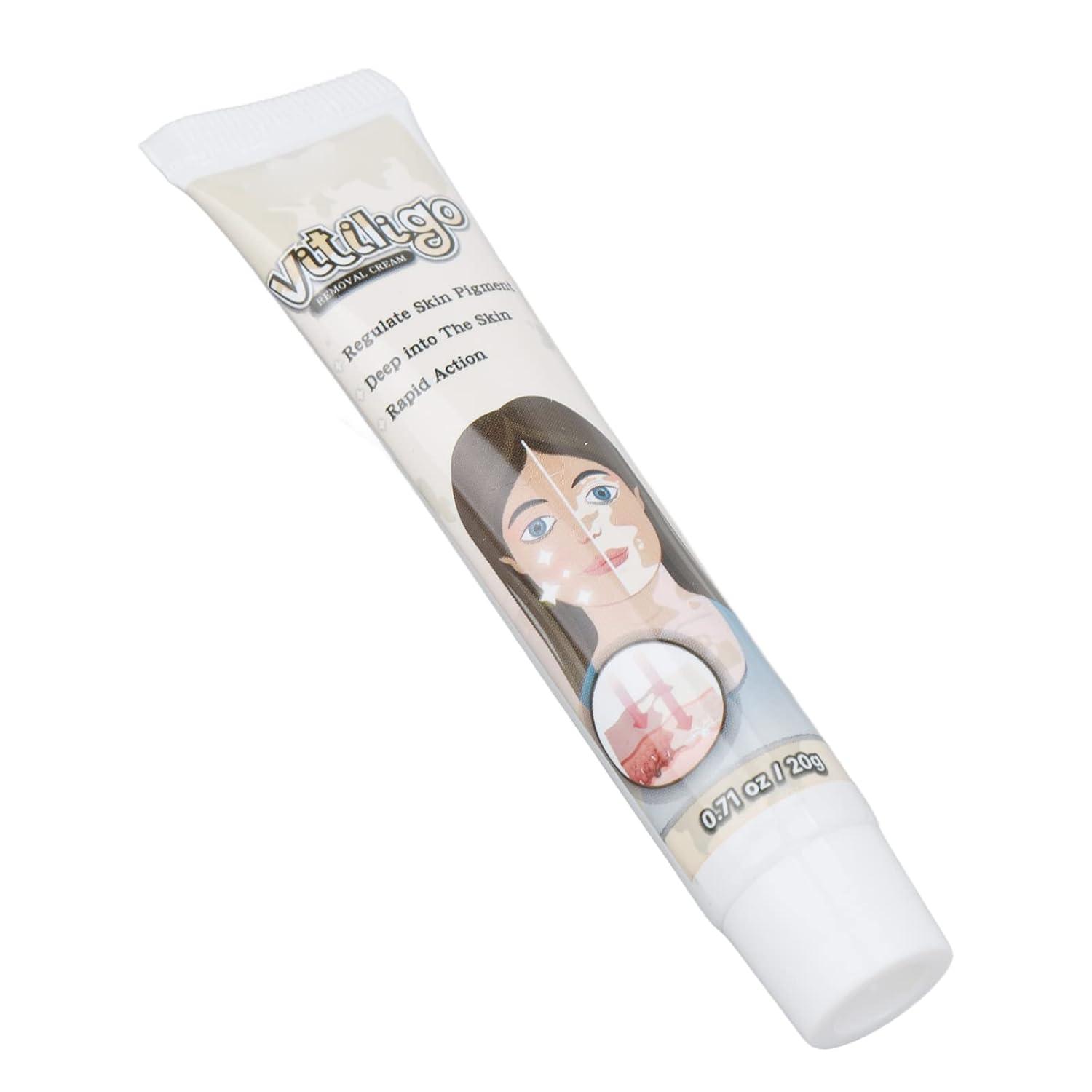 Professional Vitiligo Cream with Herbal Extract for Skin Pigmentation ...