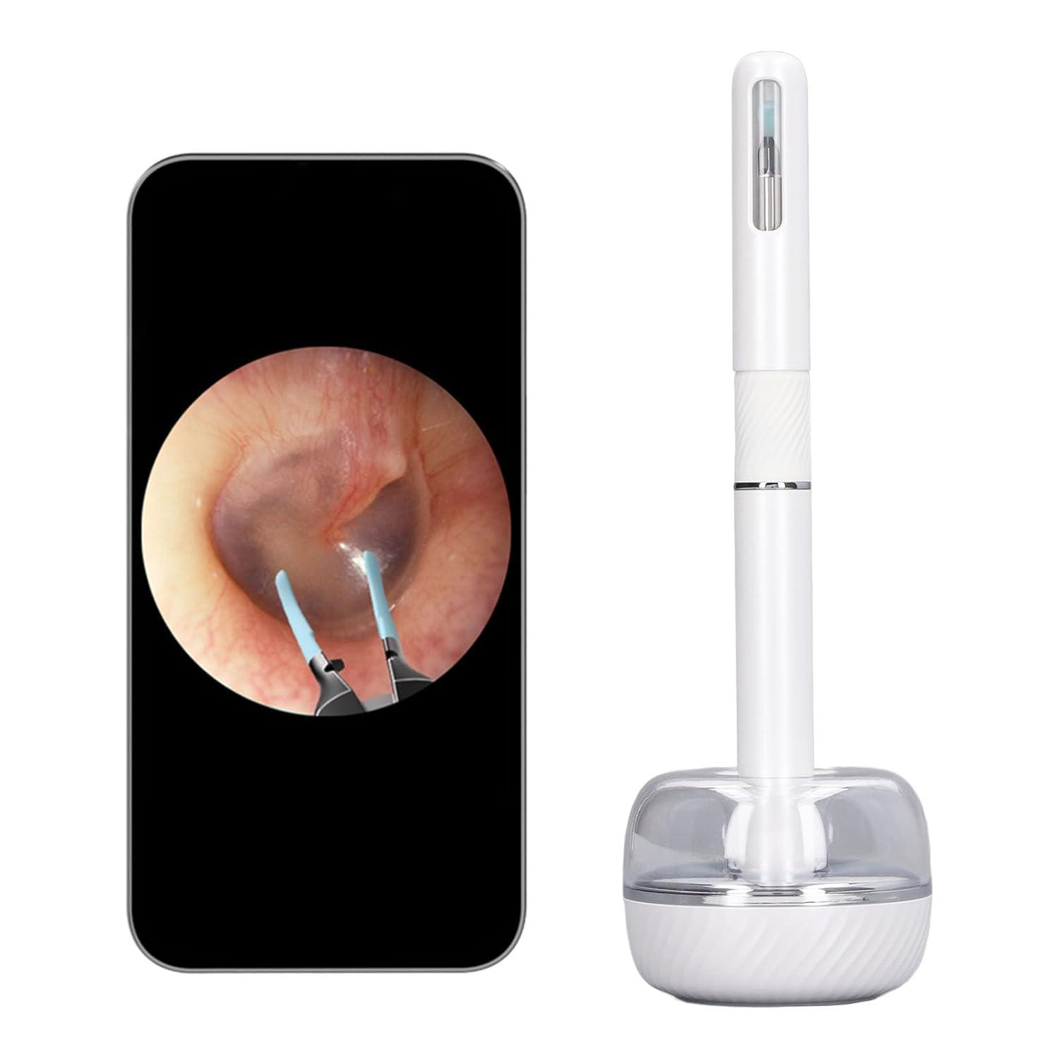 Smart Visible Ear Cleaner | Ear Wax Removal Tool with 10MP HD 360 ...