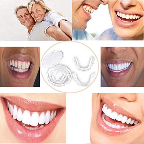 Temporary Fake Dentures - Alternative Solution for Missing, Broken ...