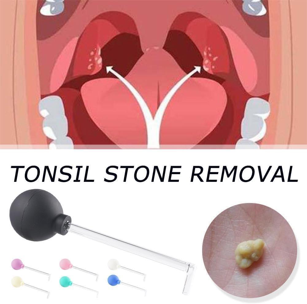 1PC Tonsil Stone Remote Tool - Manual Ear Mouth Wax Cleaning Remover ...