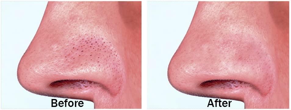 Futuristic Korean Exfoliating Glove for Smooth Skin - Remove Dead Skin ...