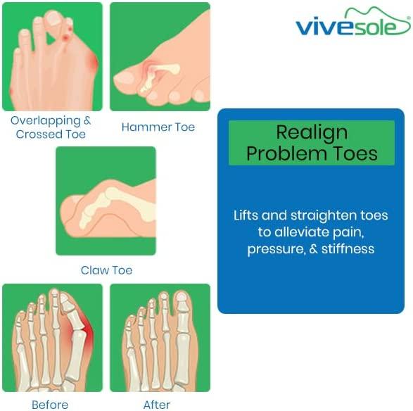 ViveSole Toe Straightener Splint Pair - Metatarsal Support for Hammer ...