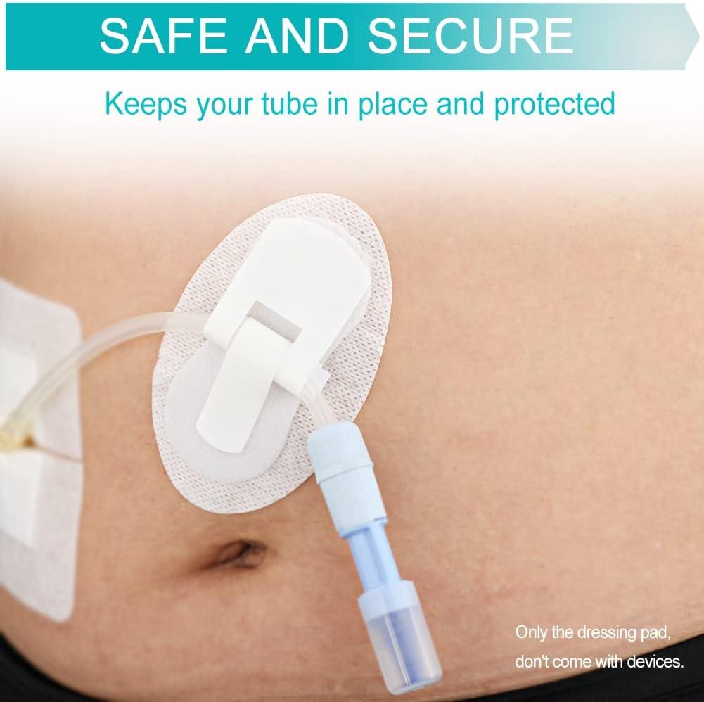 EaseToU Feeding Tube Cover Catheter Fixiation J Peg Tubing Pads ...