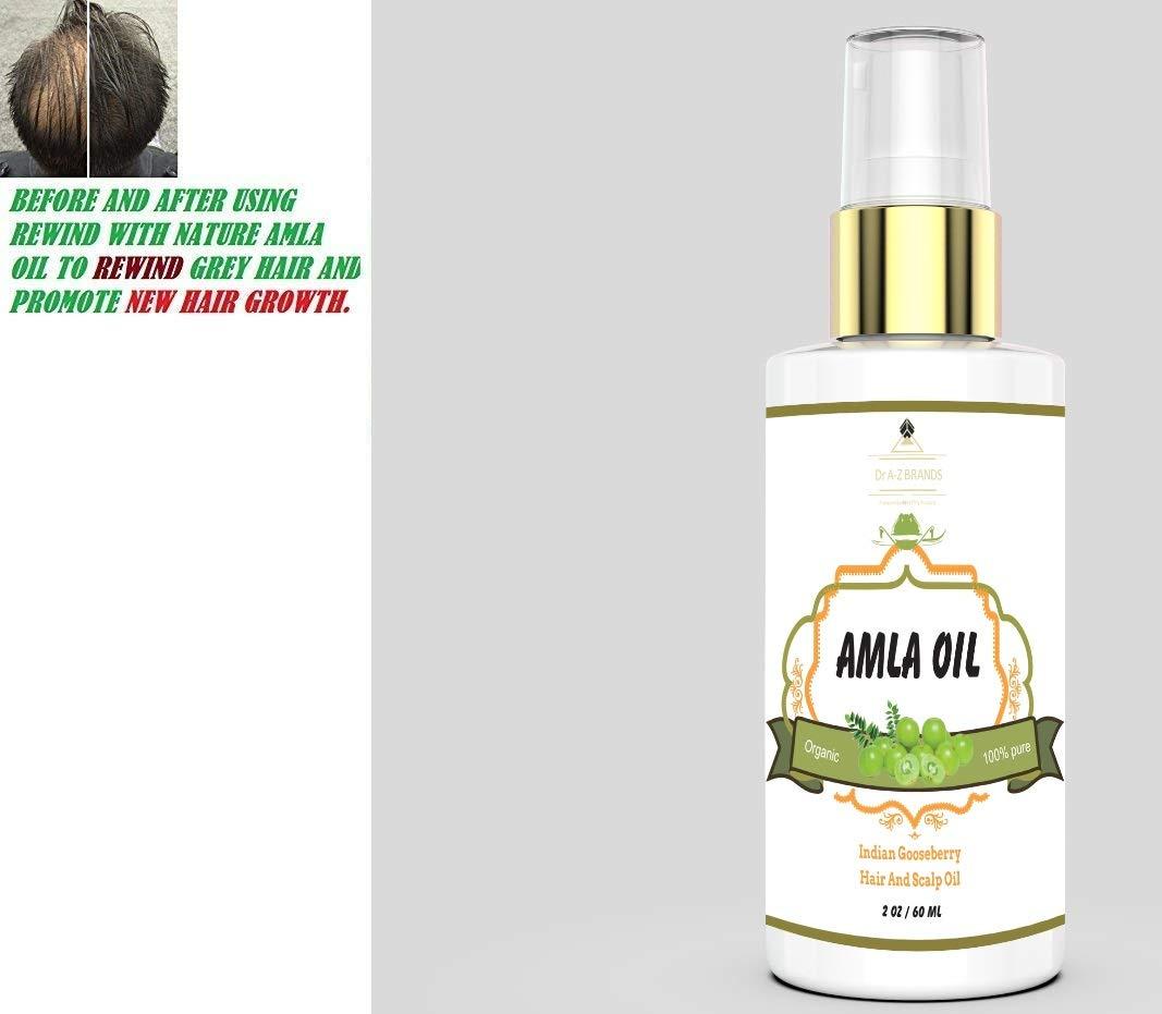 Organic Amla Oil for Hair Growth - 100% Pure Indian Gooseberry Scalp ...