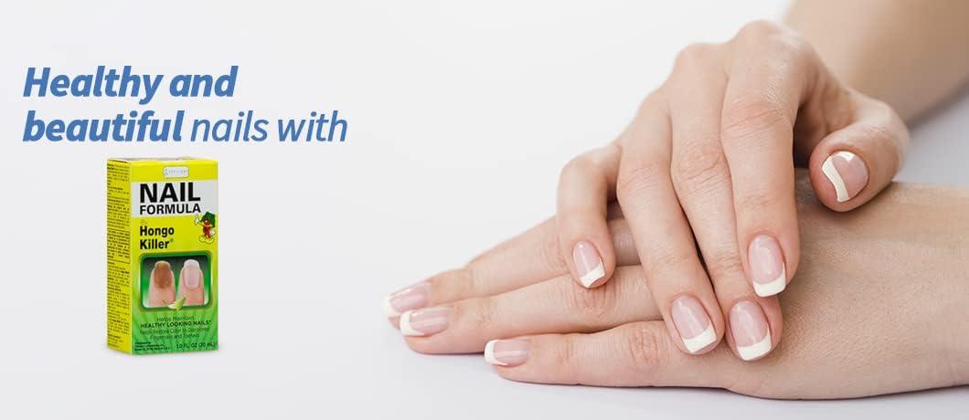 Hongo Killer Antifungal Nail Formula 1.00 Fl Oz for Healthy Nails | Buy ...