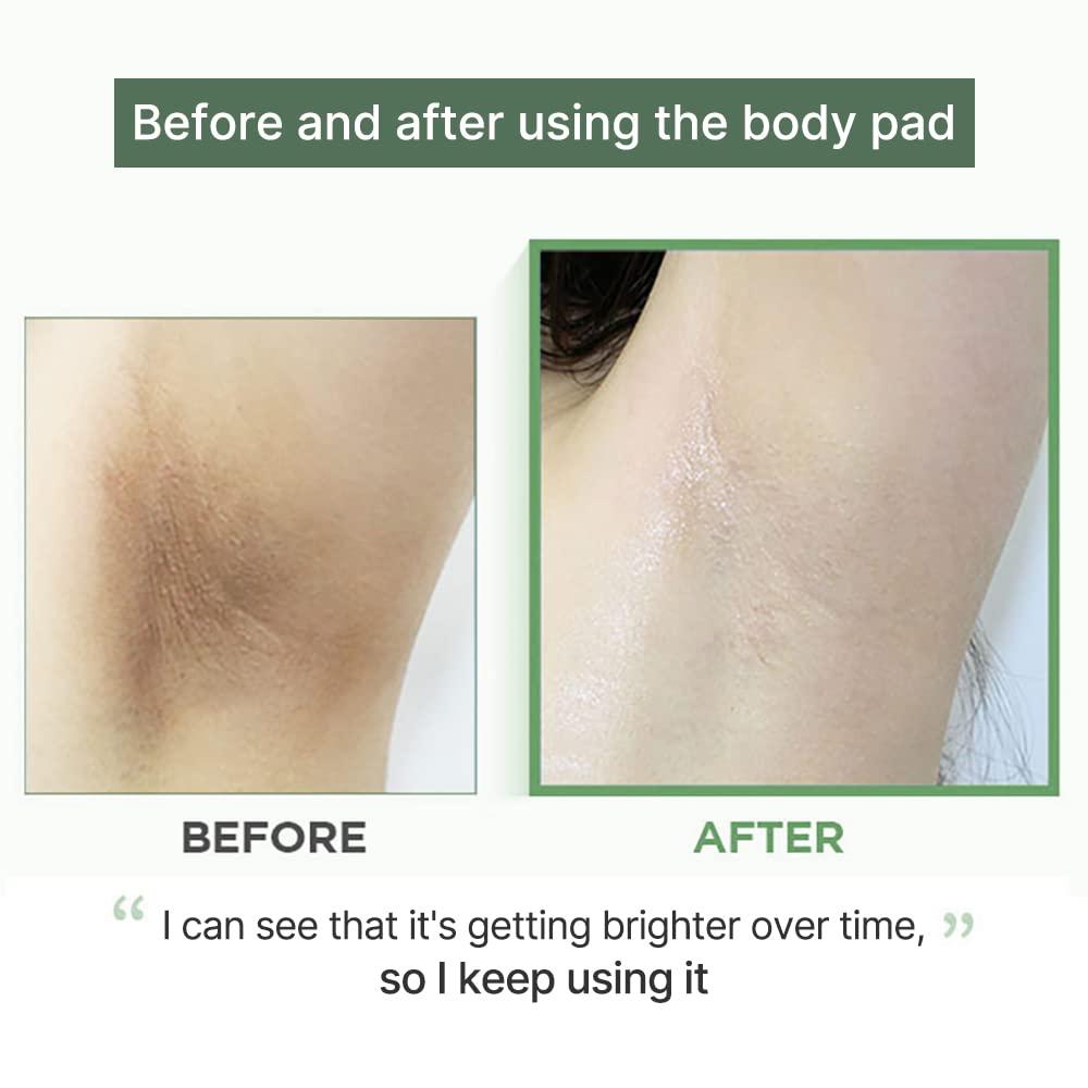 Celimax Body Brightening Pad with Green Tea & Vitamin B - Armpit ...