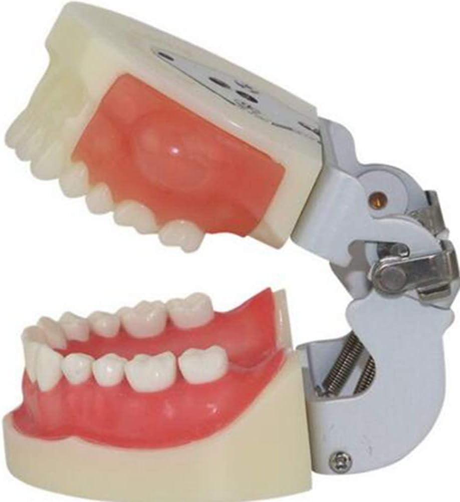 Professional Dental Model for Incision & Drainage of Abscess - Ideal ...
