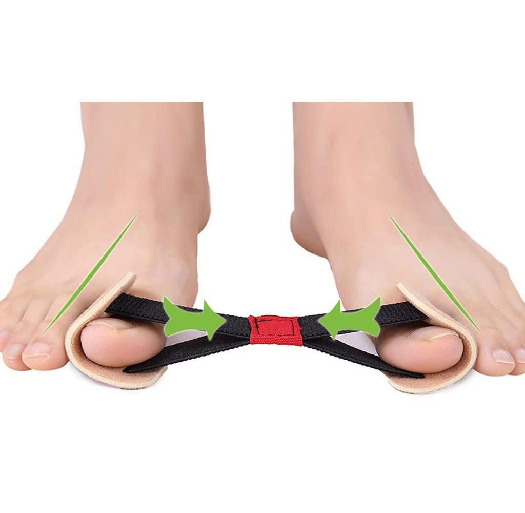 cn herb Hallux Valgus Training Belt Corrector Day and Night with Puller ...