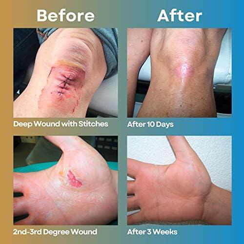 MEDIQUICK Wound Hydrogel Spray 4oz Bottle - First Aid Ointment for Cuts ...