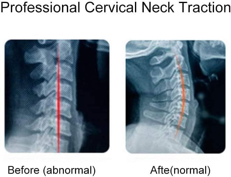 Safwel Neck Support: Adjustable Hinges & Cervical Tractor for Pain ...