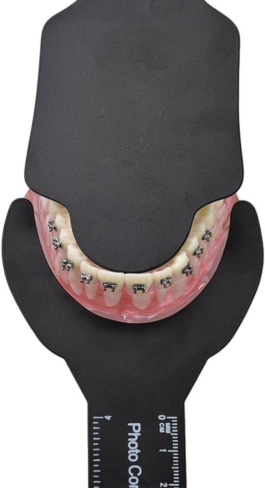NIEI C-2B Oral-Orthodontic Photography Contrast Board | Perfect Oral ...
