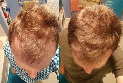 DIY AHK Copper Peptide Solution for Scalp Hair - AHK-Cu Formula | Buy ...