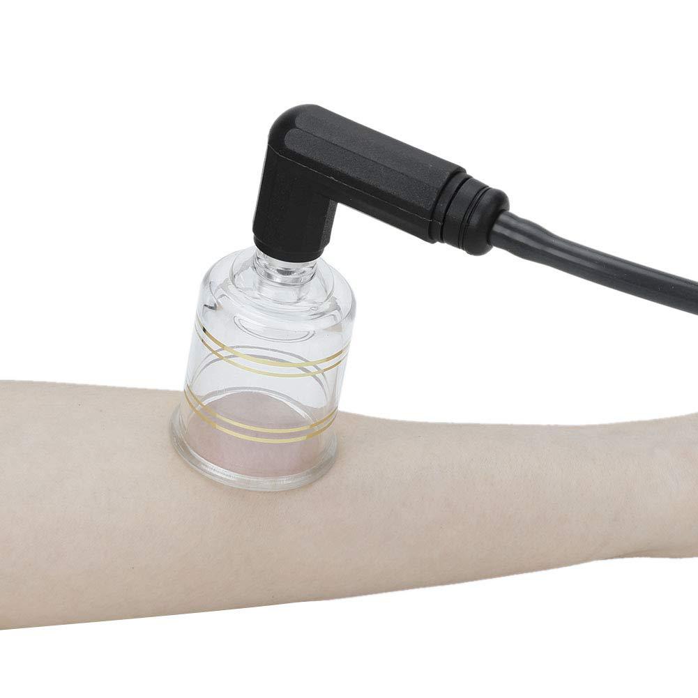 Cupping Jars Set - Traditional Chinese Cupping Tools for Pain Relief ...
