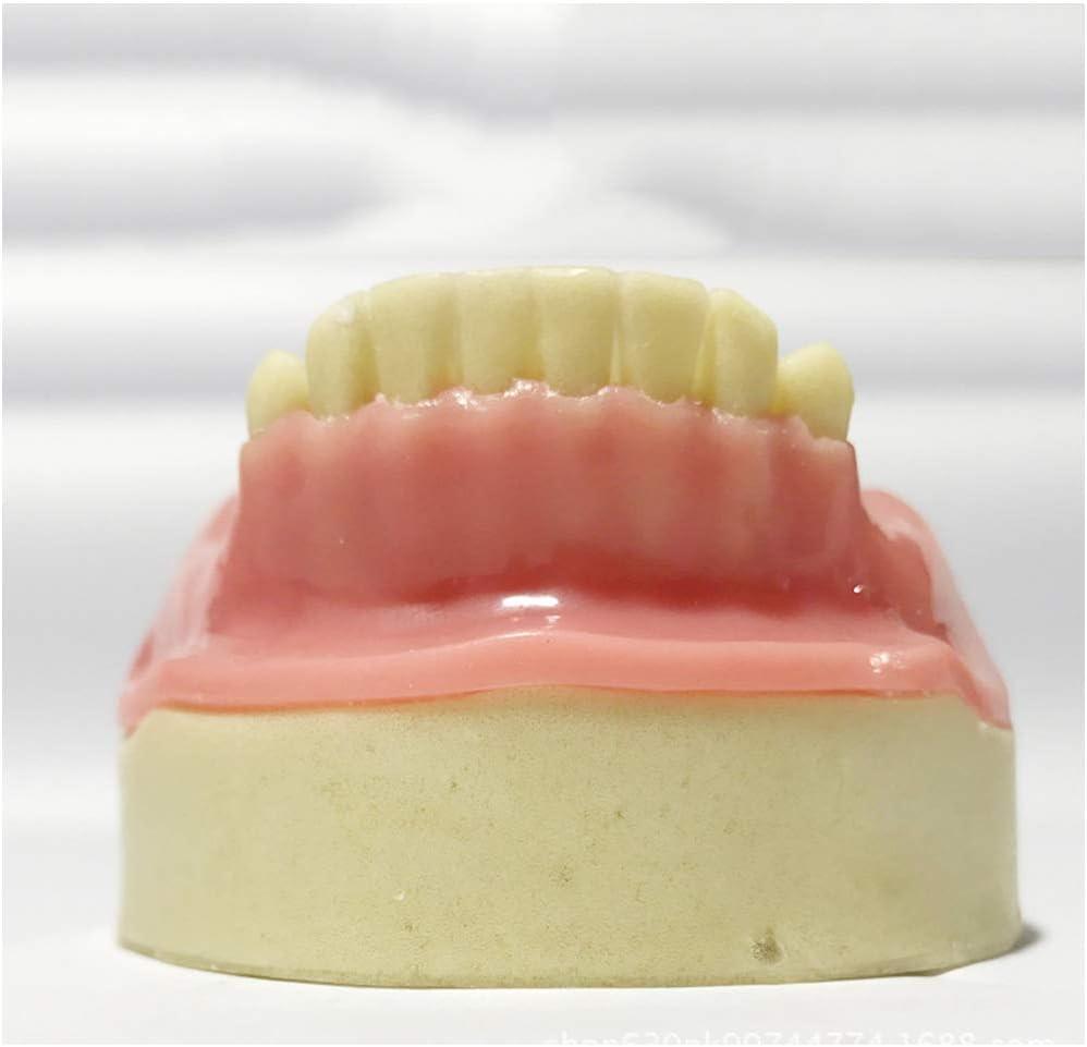 Buy Fhuili Dental Implant Practice Model - Mandibular Missing Teeth ...