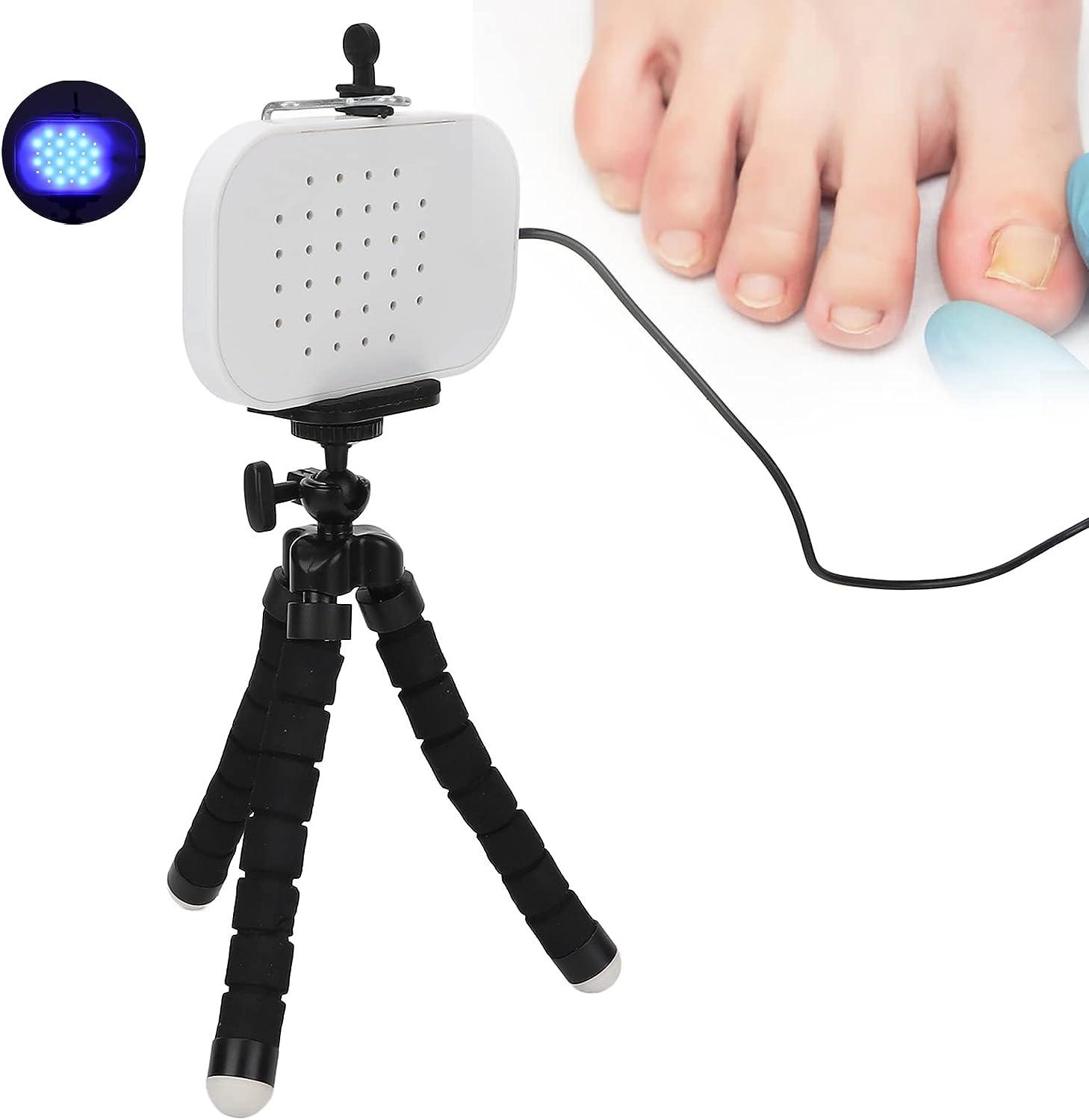 Nail Fungus Treatment Device - Safe & Quick Toe Nail Remover for ...