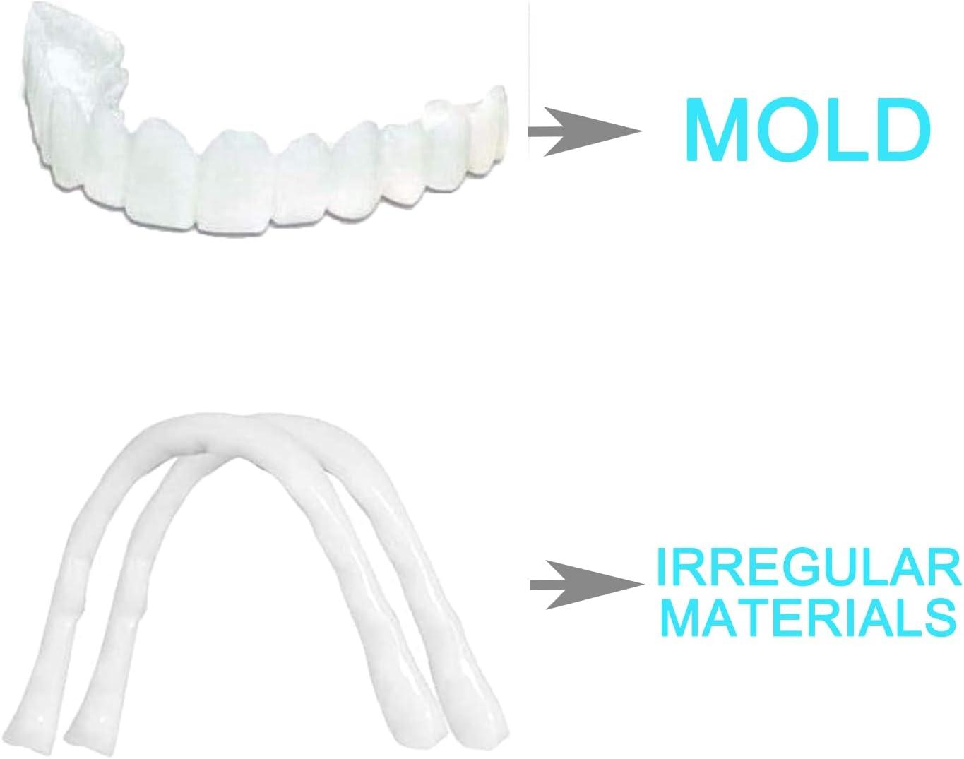 GAWIE Customizable Temporary Fake Teeth Molds for Snap-In Dentures ...