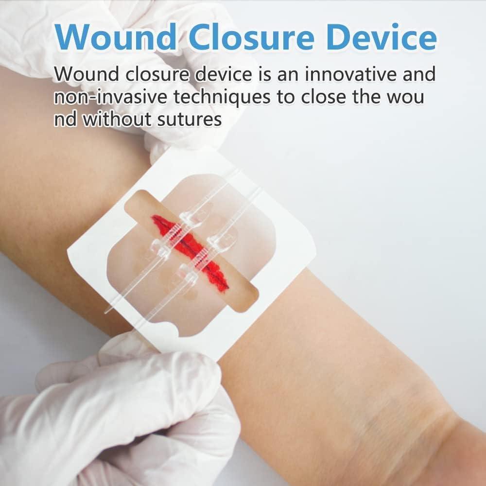 Smerphox Wound Closure Strip - Sterile First Aid Band Kit for Emergency ...