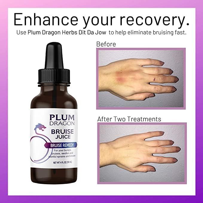 PlumDragon Dit Da Jow Bruise Juice Liniment - Whole Herb Formula for ...