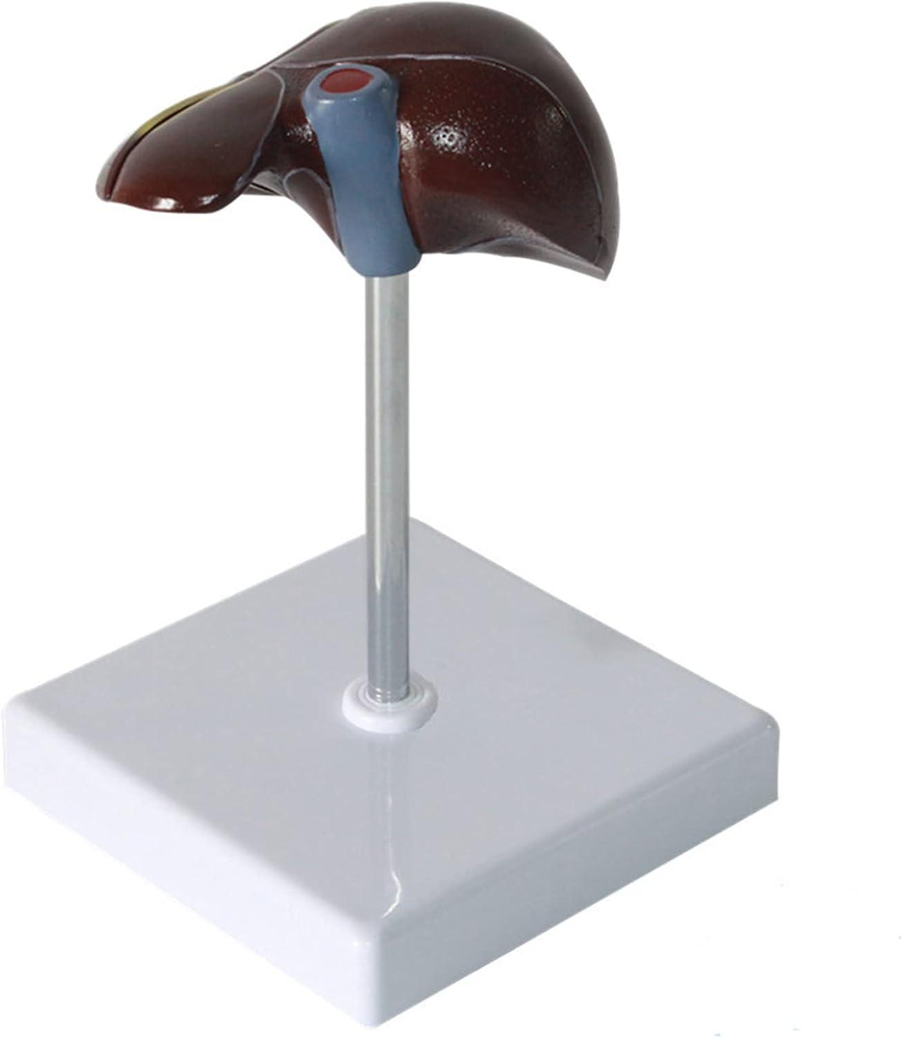 Liver Anatomy Model Human Liver Disease Model Liver Fat/Cirrhosis ...