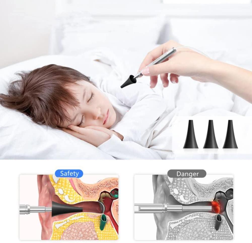 TPARIS Ear Otoscope Camera with 5 Screen - 3.9mm HD Ear Wax Removal ...