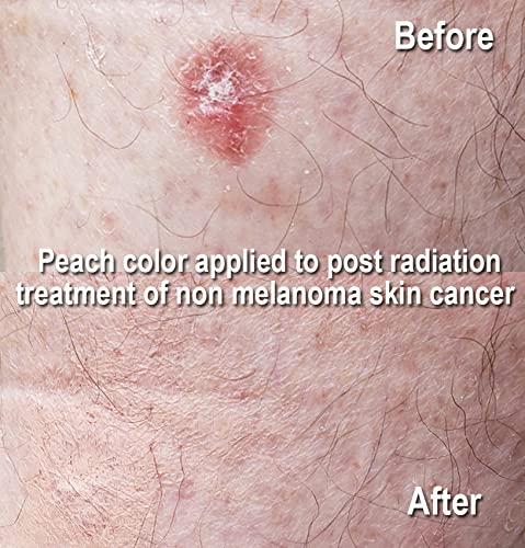 Derma JAM Wound Concealer (Cocoa) - Protective Ointment for Burns ...