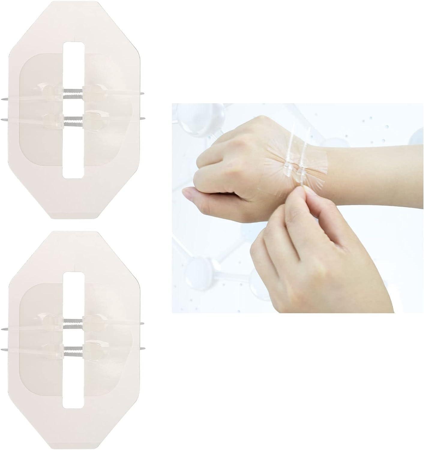 Zip Stitch: Painless, Waterproof Skin Closure Device for Wound Care ...