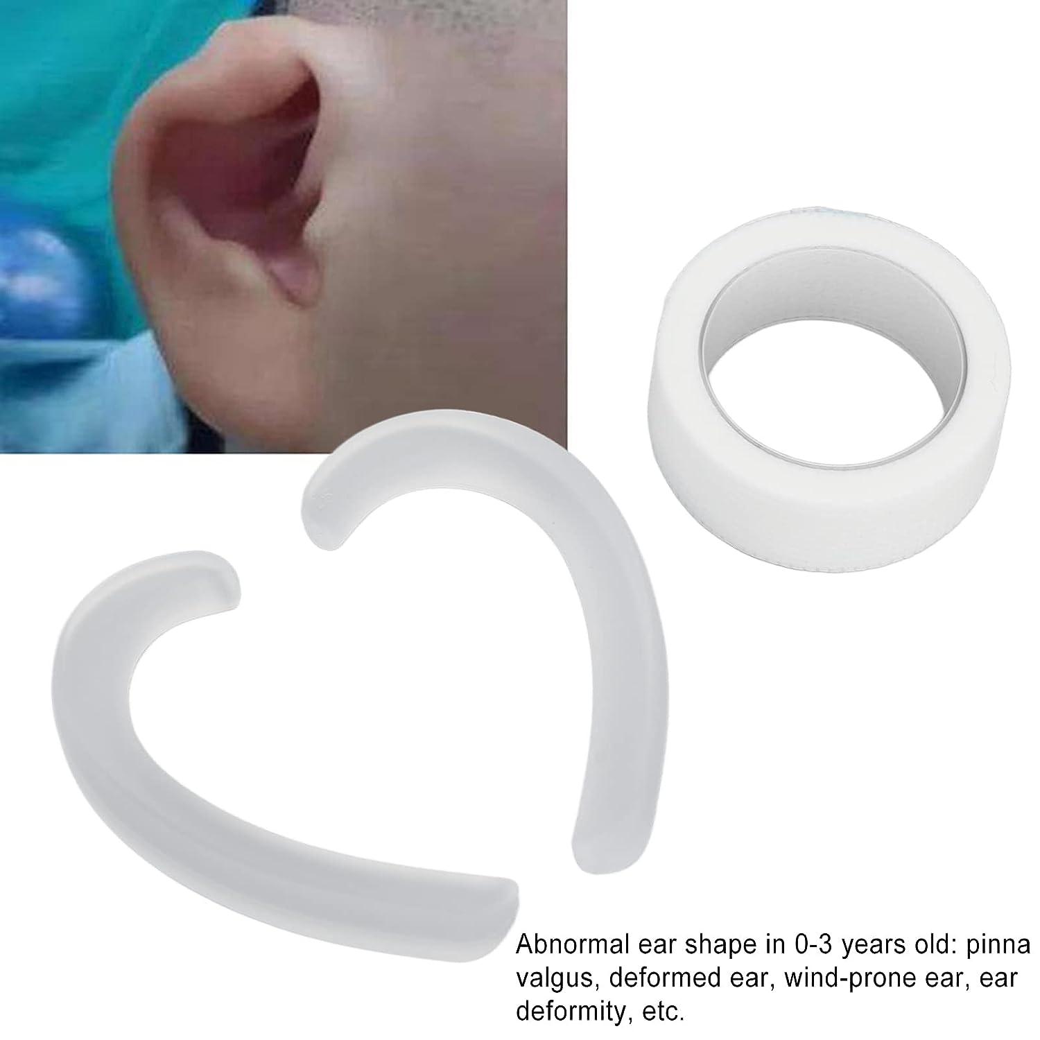 Infant Ear Corrector with Locator | Gentle Baby Ear Tape | Deformed Ear ...