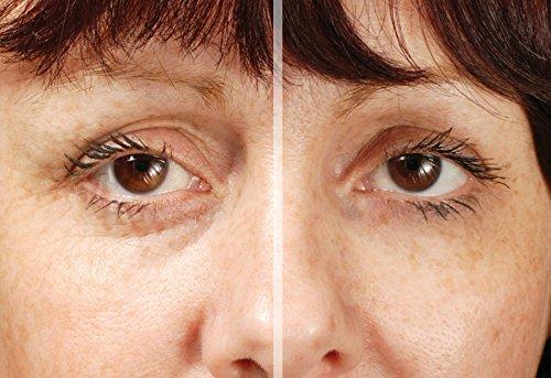 Rox Flawless Eyes by RX | Premium Eye Care for Radiant Skin | Shop ...