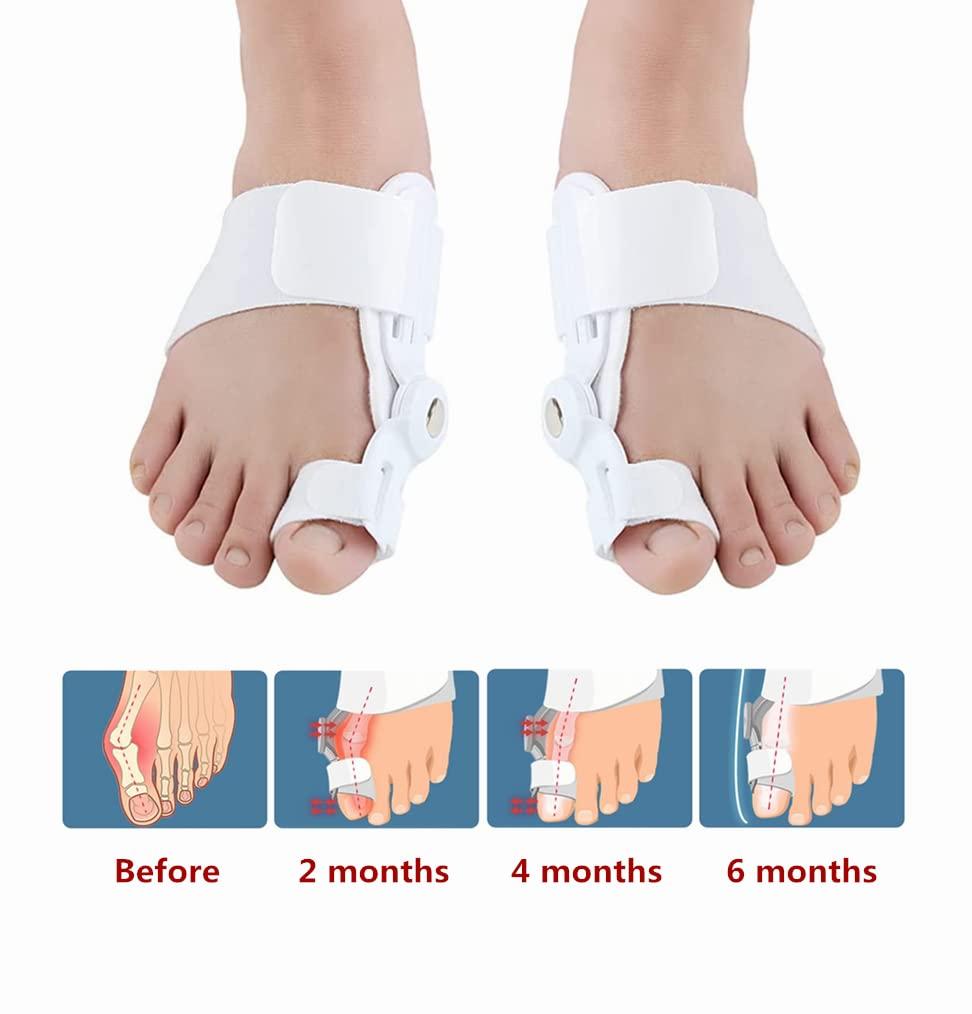 Big Toe Bunion Relief Pads with PE Bracket - 1 Pair/Set for Men & Women ...