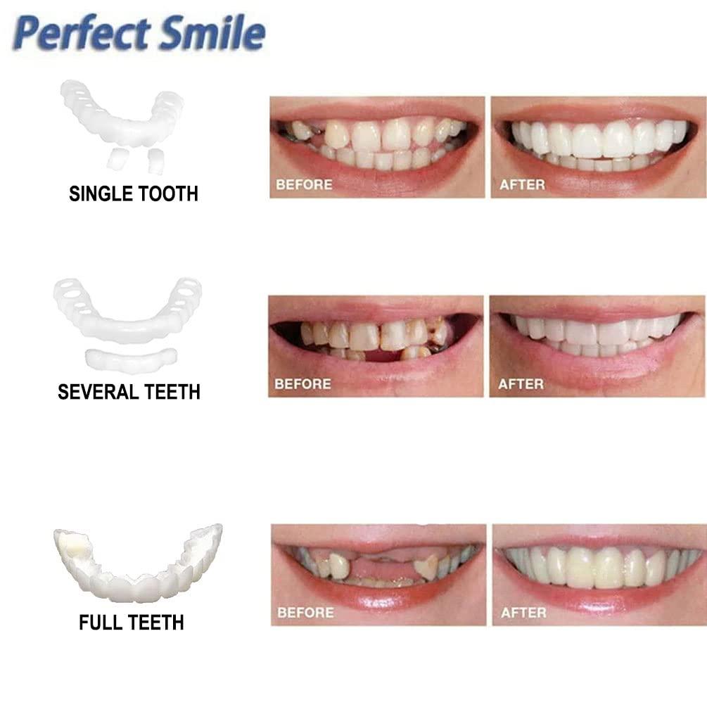 Perfect Bottom Teeth