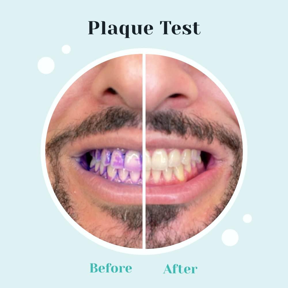 AutoBrush Pro Adults U-Shaped Automatic Toothbrush - Soft Nylon ...