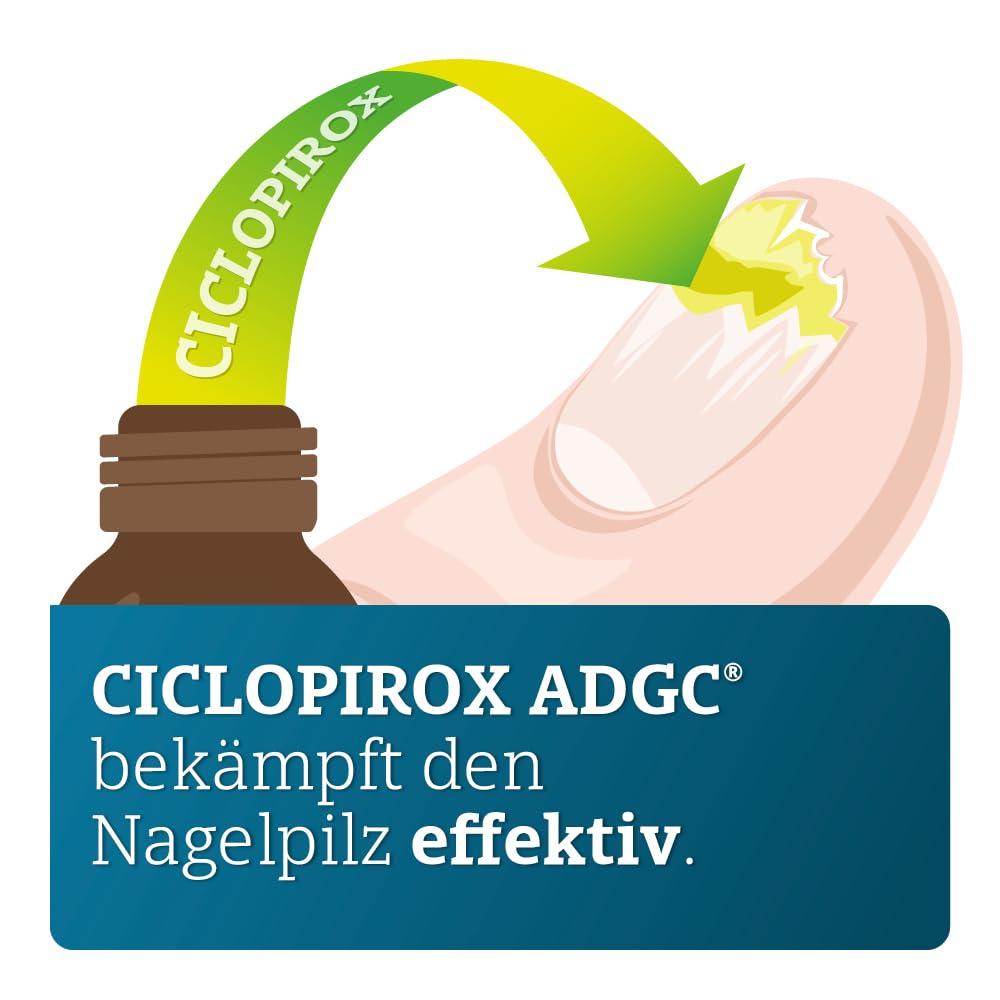Ciclopirox ADGC Nail Polish 80mg/g - Treat Nail Fungus - 6.6ml ...