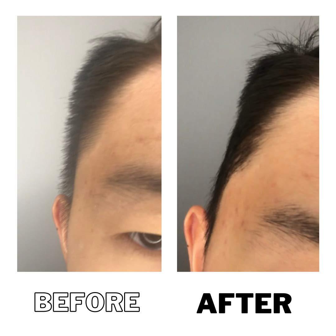DPERM Serum Concentrate Kit - Enhance Your Down Perm Results | Buy Now ...