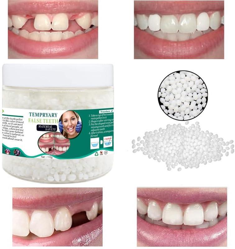 LDADGF Plastic Tooth Adhesive - Perfect Temporary Filling for Broken ...
