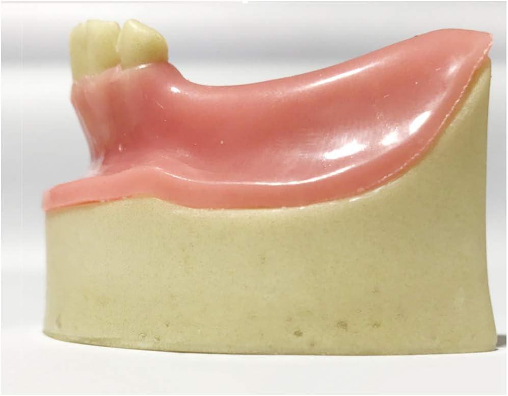 Buy Fhuili Dental Implant Practice Model - Mandibular Missing Teeth ...