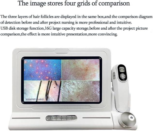 11 Inches Skin Diagnosis Hair Analyzer Hair Scalp Detector with 50X/200X Lens 4 Picture ...