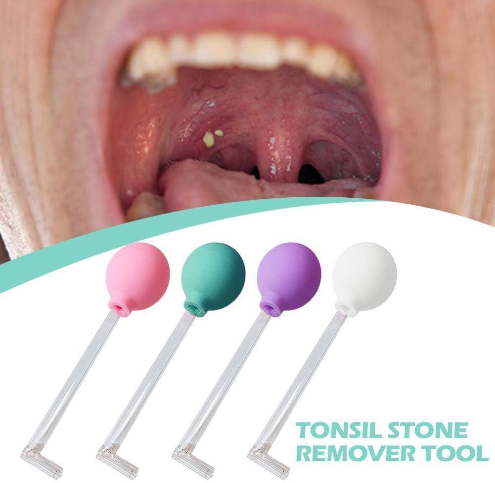 Portable Tonsil Stone Remover Kit - Oral Suction Tool for Adults ...