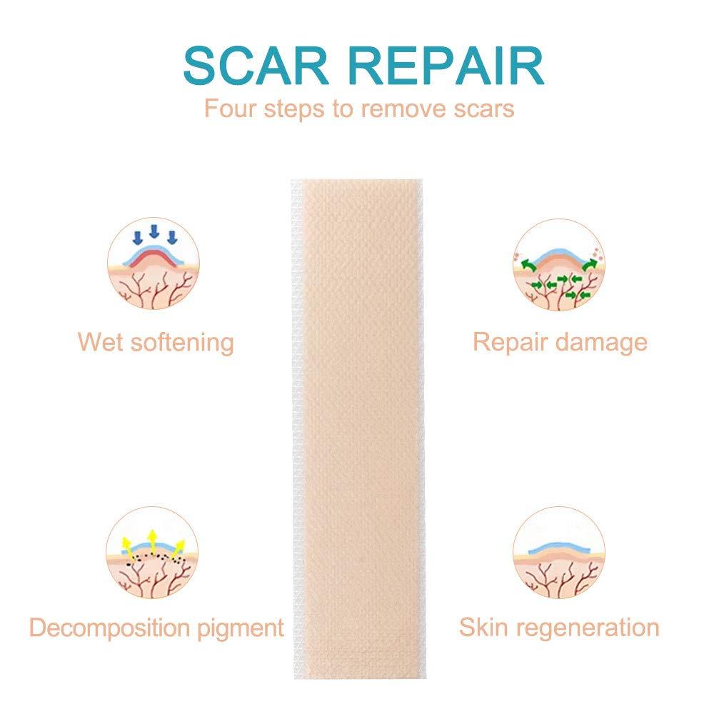 Silicone Scar Removal Sheets Professional Softening and Flattening Scar ...